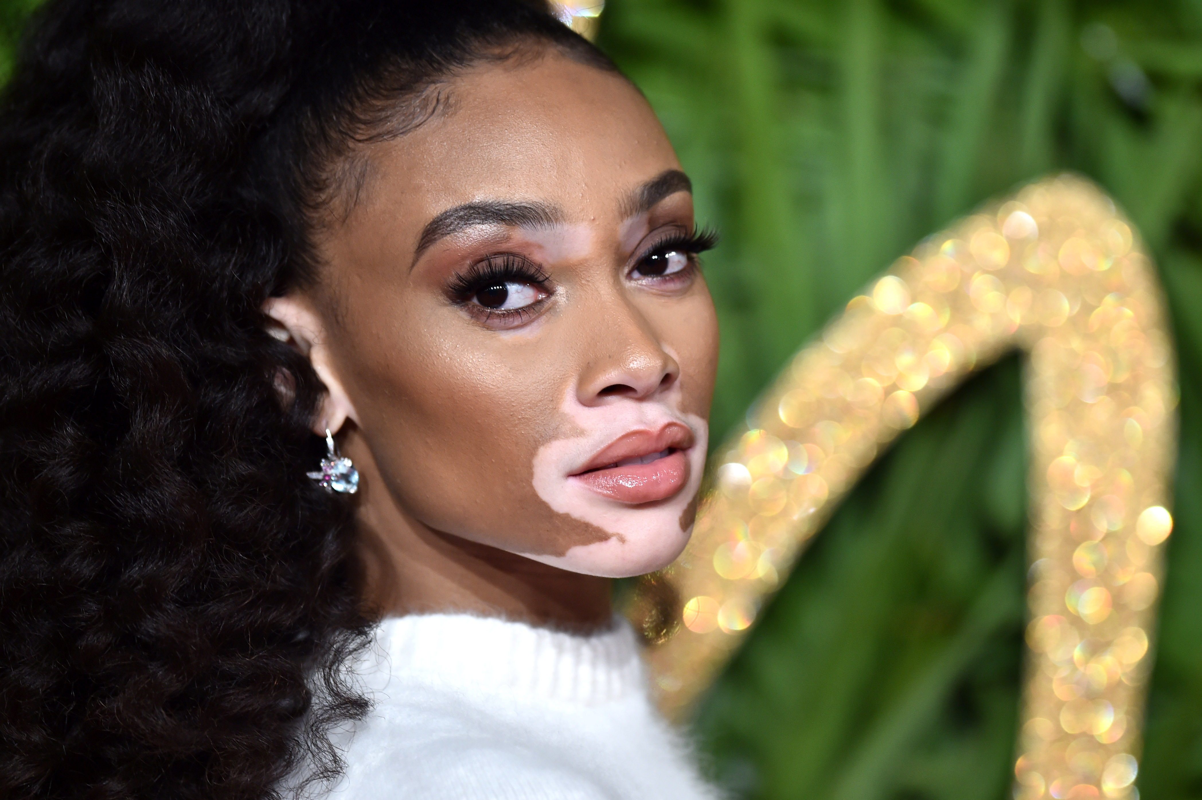 Why model Winnie Harlow is calling out the tabloids for referring to ...