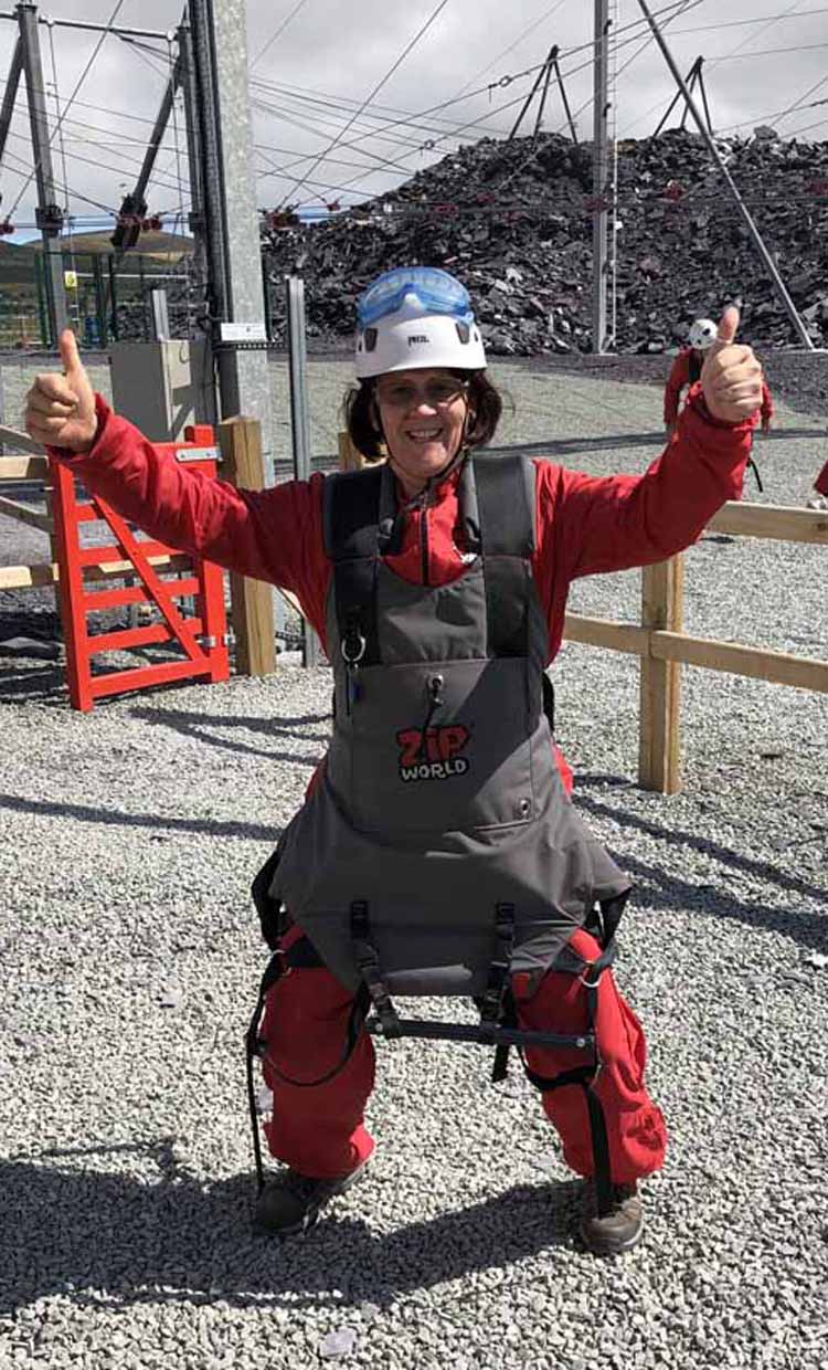 NHS nurse who lost limbs to sepsis dubs stumps “beautiful” as ...