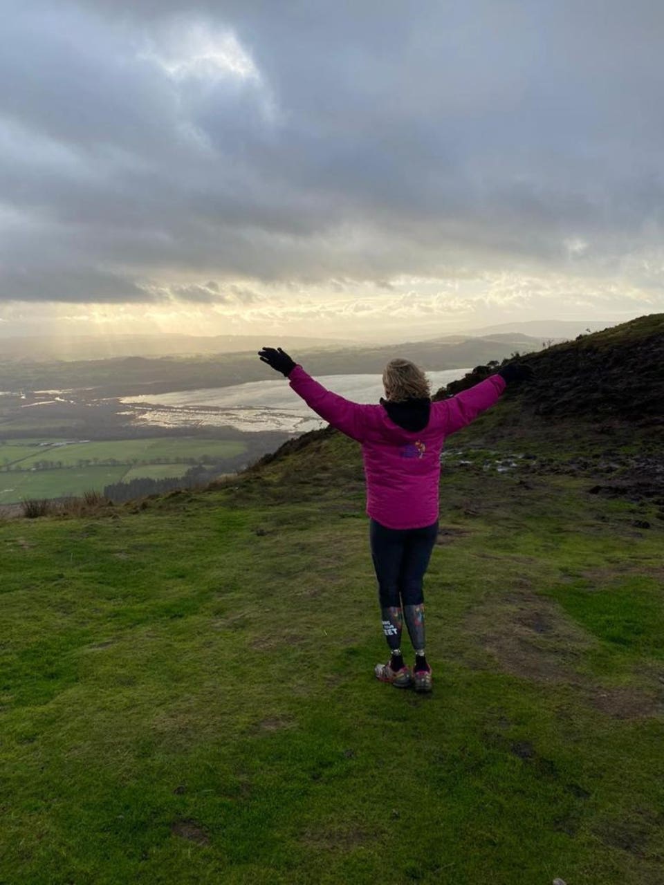 Double hand transplant patient hails ‘phenomenal’ progress two years on ...