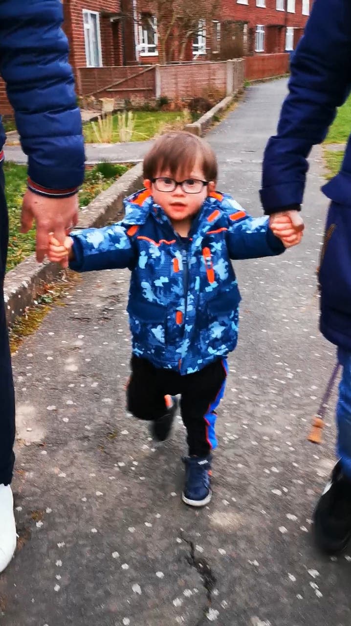 ‘Determined’ two-year-old walking half-a-mile a day for Down’s syndrome ...
