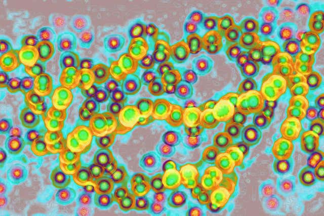 What are the signs of Strep A infection? | Shropshire Star