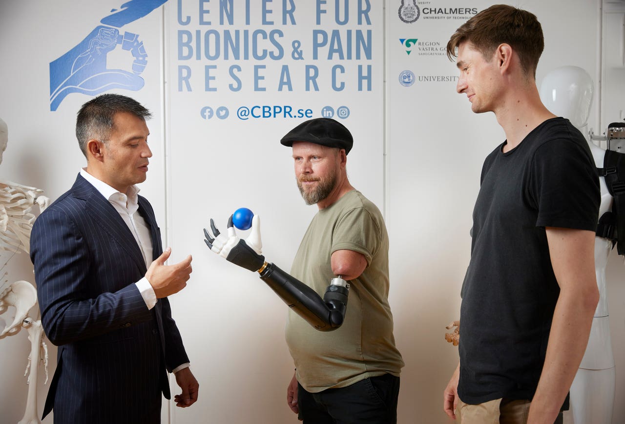 Above-the-elbow amputee ‘moves individual fingers in bionic limb in ...
