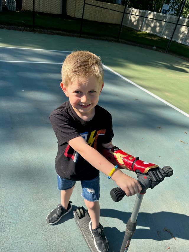 Boy, five, born without hand becomes world’s youngest to get bionic ...