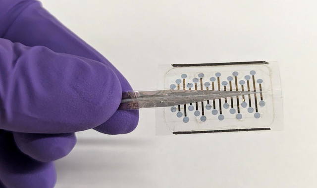 Folding implants that expand in the brain ‘could make epilepsy ...