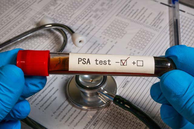 Prostate cancer screening: Final guidance recommends against testing ...
